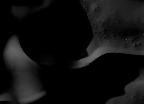 Pelvic And Perineal Reconstruction Bris Dr Tav Read