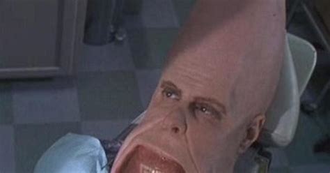 Picture Of The Man Who Has Multiple Hyperdontia Imgur