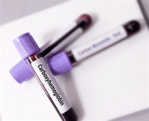 5 Carboxyhemoglobin Quantitation Royalty Free Photos And Stock Images