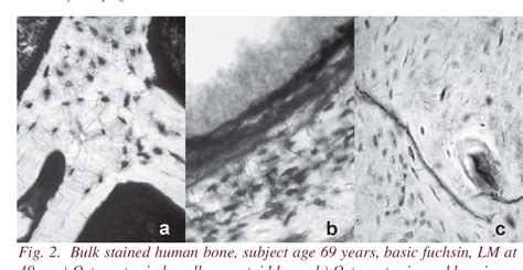 Figure 2 From Lacuno Canalicular Pathways And Barriers In Perilabyrinthine Bone Semantic Scholar