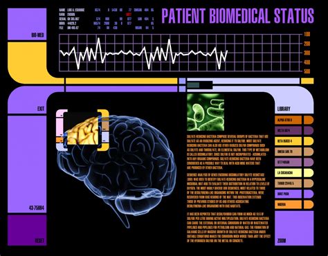 Oberth Class Msd The Movies Style — Scifi Oberth Class Msd The Movies Style — Scifi
