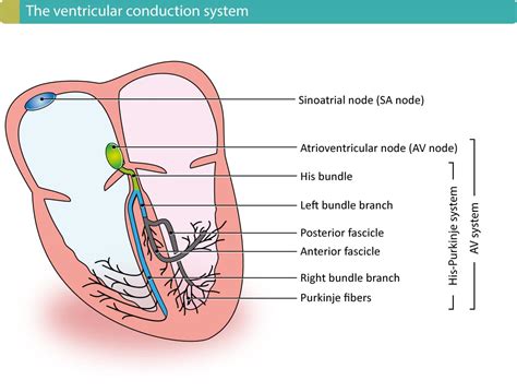 A Functional Bundle Branch Block Means Which Of The Following