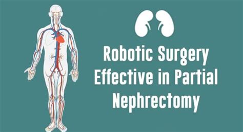 Robotic Surgery Effective In Partial Nephrectomy Advanced Urology