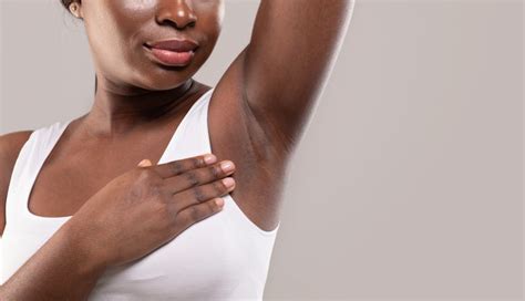 Inverse Psoriasis Symptoms Causes And Treatment