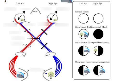 Diagram Of Optic Chiasm Quizlet