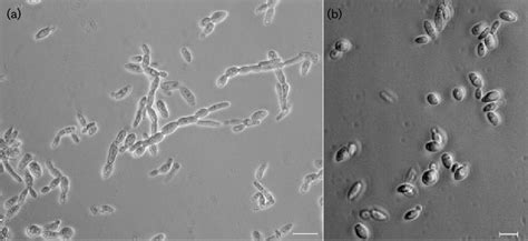 Phase Contrast Micrographs Showing Budding Cells And Pseudomycelium Of
