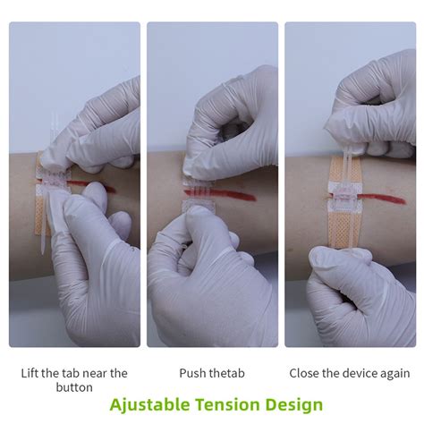 Non Woven Wound Closure Device Single Type Skin Colorwound Closure