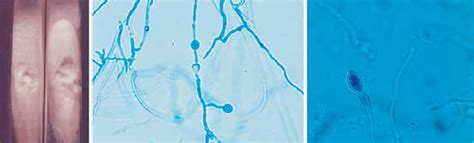 Microsporum Audouinii