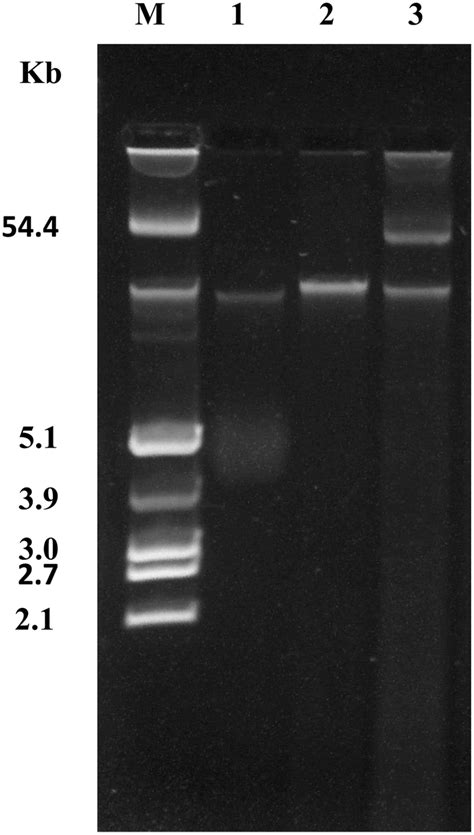 Examples Of Some Pseudomonas Plasmid Profiles Lane M Molecular Size Download Scientific