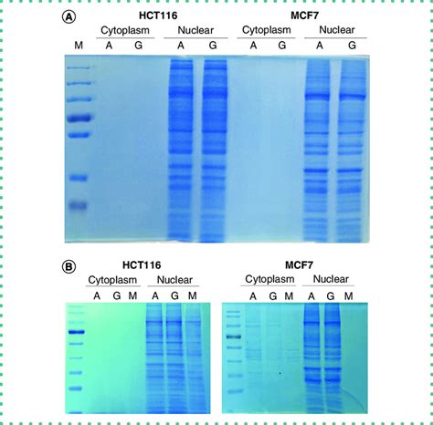 Nonspecific Binding Proteins With Different Beads Protein A A Or