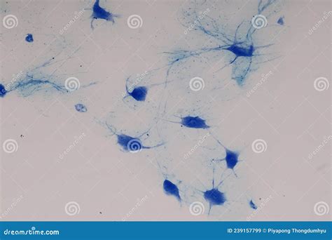 Motor Neuron And Nerve Cells Under The Microscope Stock Image Image