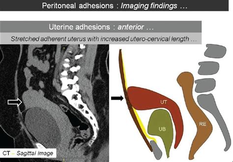 Computed Tomography And Magnetic Resonance Imaging In The Evaluation Of