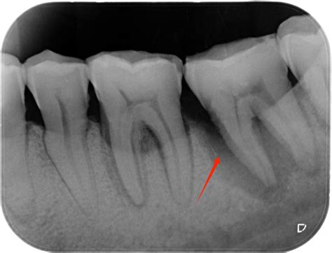 健康科普 河南赛思口腔医院