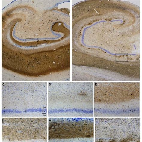 Schematic Diagram Showing The Main Perforant Pathway Projections To The