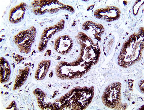 Ace2 Antibody Bsb 135 Bio Sb