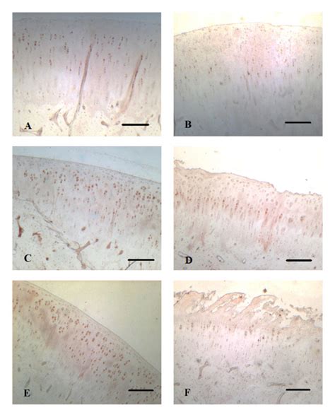 Immunohistochemical Staining Of Pth1r A Pth1r Expression 3 Weeks
