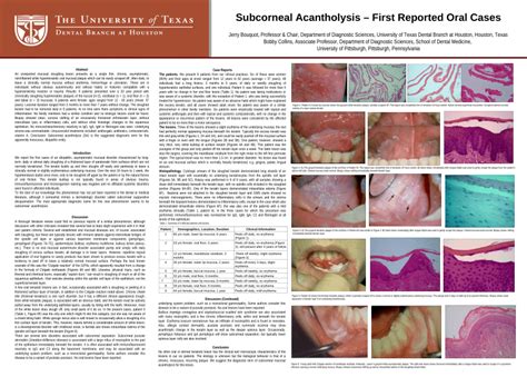 Pdf 2009 Aaomp Subcornealacantholysis Poster