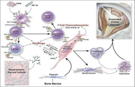 Pathophysiology Of Thyroid Eye Disease Ted 11 Download Scientific