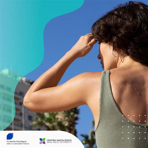 Golpe De Calor Centro Oncológico Anna Rocca De Bonatti