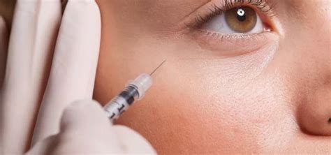 Anti Wrinkle Injections Dr Eithne Brenner