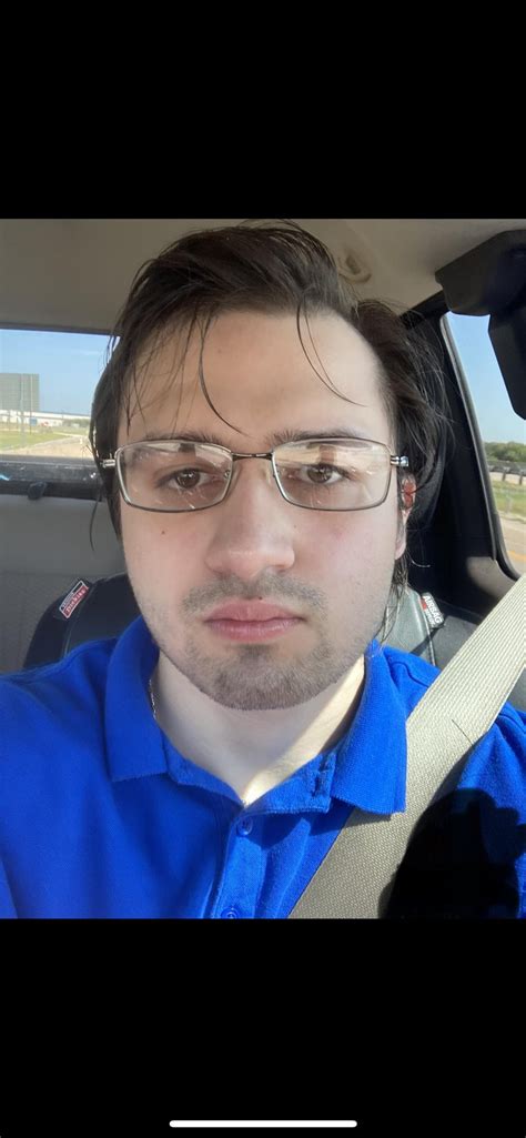 Am I Diffuse Thinning R Bald