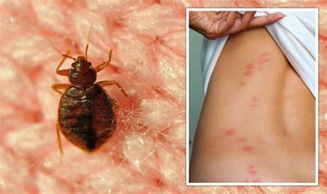Bed Bug Bites What Do Bites Look Like The Most Common Signs Of An