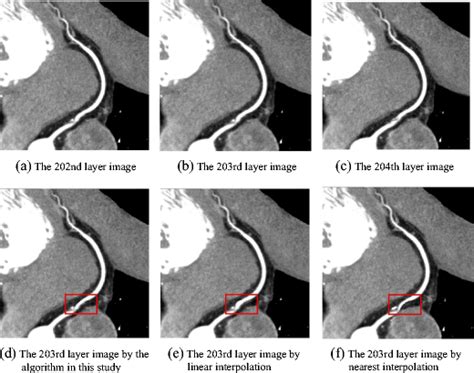 results of image interpolation download scientific diagram