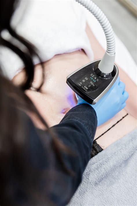 Exion In Houston Refresh Dermatology