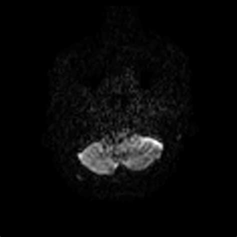 Data Collection — Scil Longitudinal Mri Database 01 Documentation