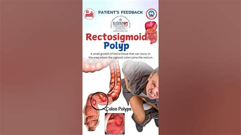 𝐏𝐚𝐭𝐢𝐞𝐧𝐭 𝐅𝐞𝐞𝐝𝐛𝐚𝐜𝐤 Mr Manoj Gandhi Kaizen Hospital Rectosigmoid