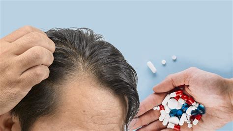 Finasteride Your Guide To Benefits Side Effects And Uses By