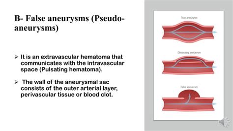 Pathology Of Atherosclerosis Dissection And Aneurysm Copy Ppt