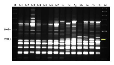 Issr Marker Profile For Seven Pairs Of Female And Male Cultivars Using Download Scientific