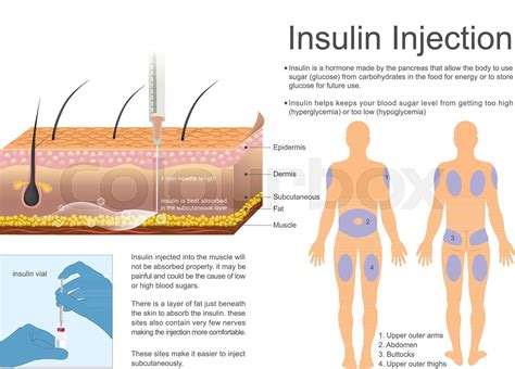 Insulin Injection Red Spots At Patricia Kelly Blog