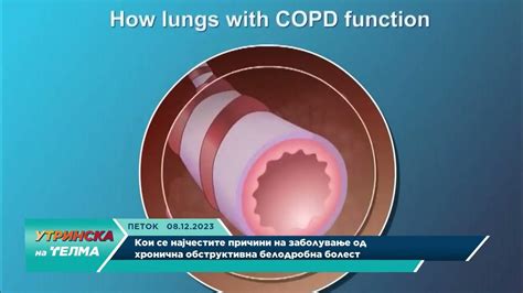 НАША УТРИНСКА ТЕМА Д р Марјан Балоски хронични белодробни болести Youtube