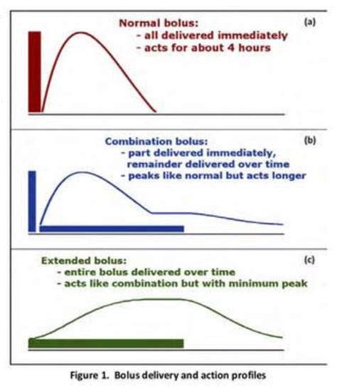 Extended Bolus With T Slim X2 Type 1 And Lada Fudiabetes