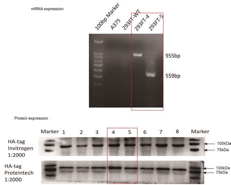 Why Our Truncated Protein Plasmid Expressed Correct Length Of Mrna But Incorrect Length Of