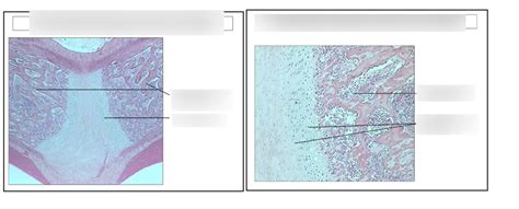 Fibrocartilage Cartilage Connective Tissue Diagram Quizlet