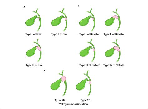 Sketches Of The Existing Classifications Of Cdc A Kims Download Scientific Diagram