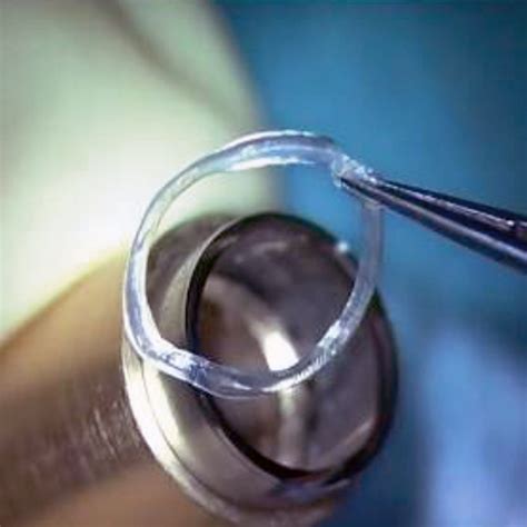 Jacob Cairs Trephine Medix 21 Surgical Looking To The Future