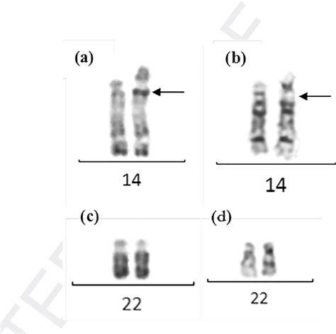 Figure 1 From Sperm Meiotic Segregation Of A Balanced Interchromosomal