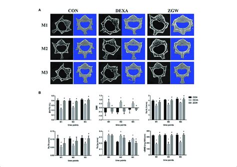 effects of zgw on bone microarchitecture and parameters determined by