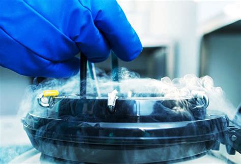 Oocyte Cryopreservation