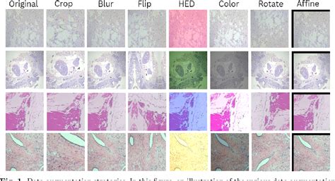 Classification Of Breast Cancer Histopathology Images Using A Modified Supervised Contrastive