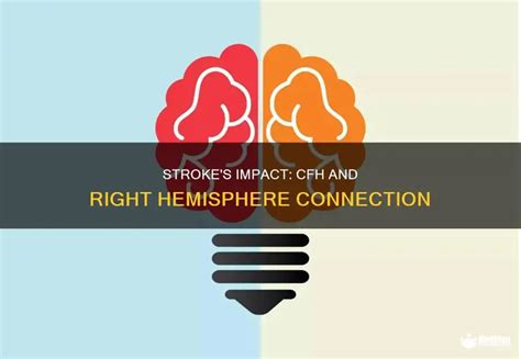 Strokes Impact Cfh And Right Hemisphere Connection Medshun