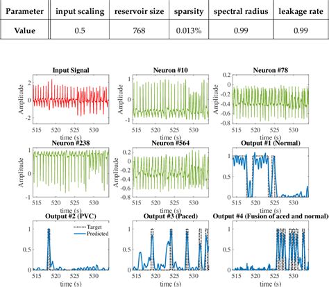 Reservoir Computing Models For Patient Adaptable Ecg Monitoring In