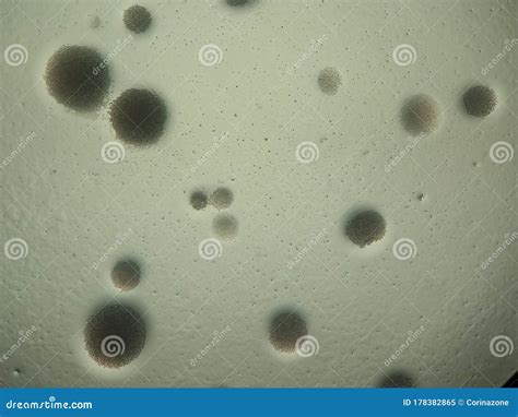 Candida Albicans Colonies Under The Microscope Stock Image Image Of Yeast Colonies 178382865