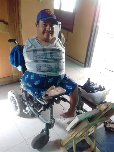 Image Tagged With Quad Amputee Congenital Deformedfoot Ajaunci On