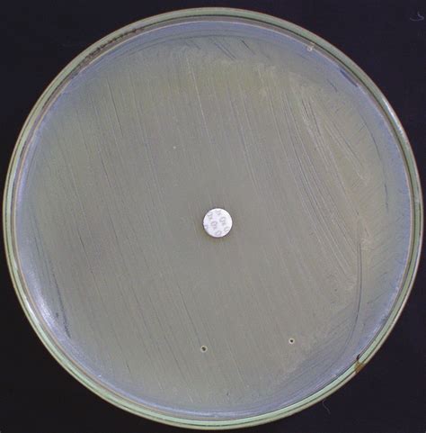 Detection Of Methicillin Resistance In Staphylococcus Aureus By