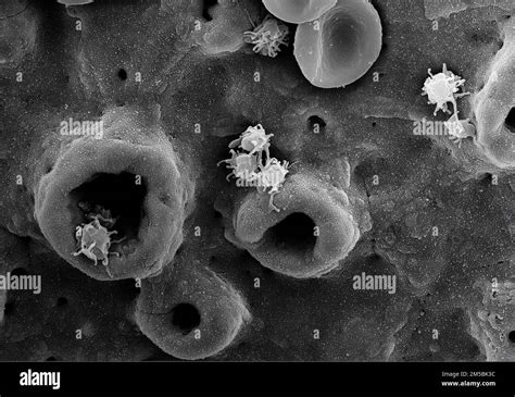 Scanning Electron Micrograph Sem Showing Activated Platelets